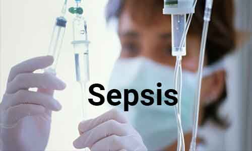 Guideline on individualized care for sepsis patients