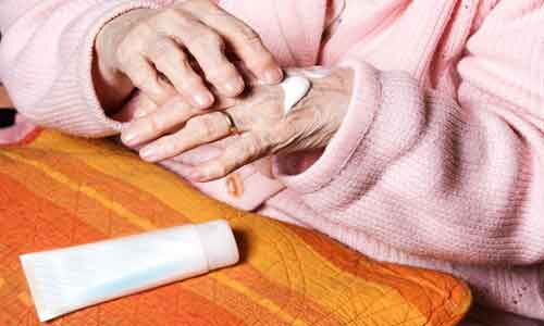 Topical NSAIDs first line treatment for musculoskeletal pain: ACP ...