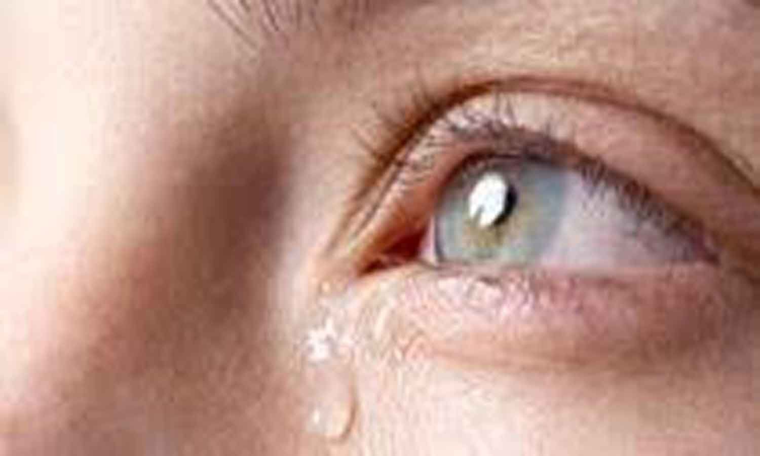 Blinking Exercises Improve Dry Eye Symptoms and Eyelid Function: Study