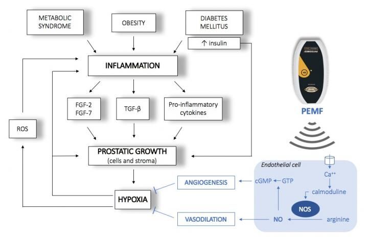 Pulsed electromagnetic field therapy reduces Prostate size and symptoms ...