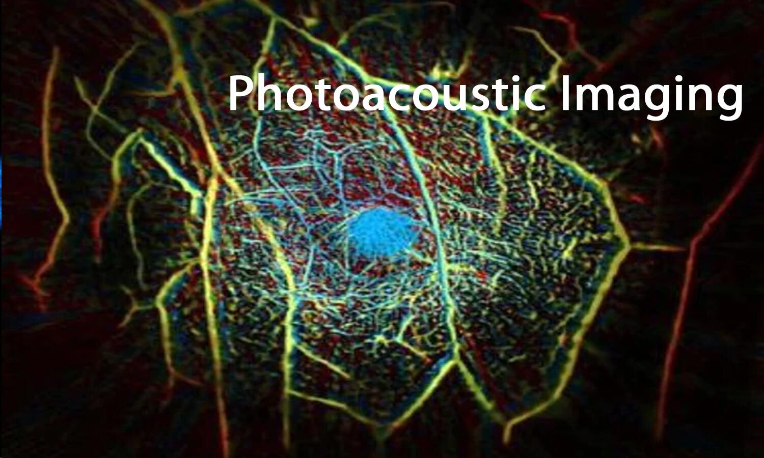 Photoacoustic imaging- New imaging for safer heart procedures