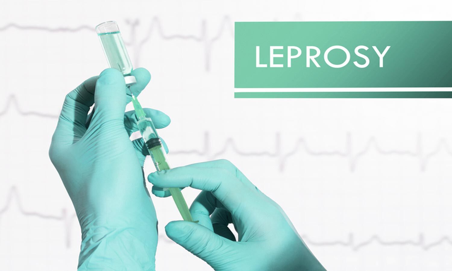 Single-dose rifapentine may prevent leprosy spread in household ...