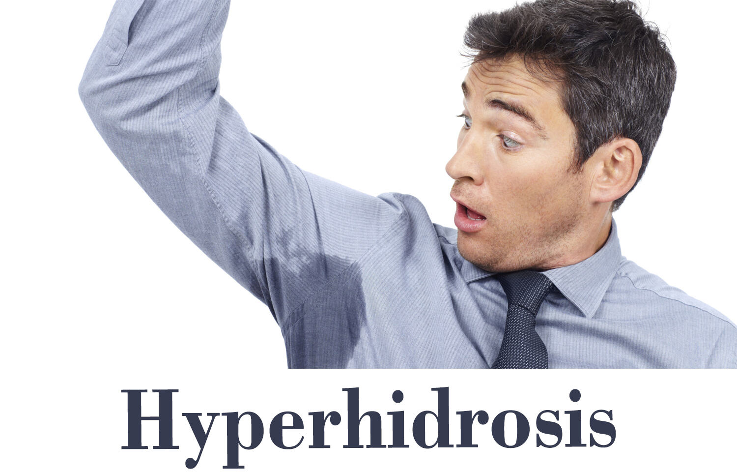 Sofpironium may reduce disease severity in primary axillary ...