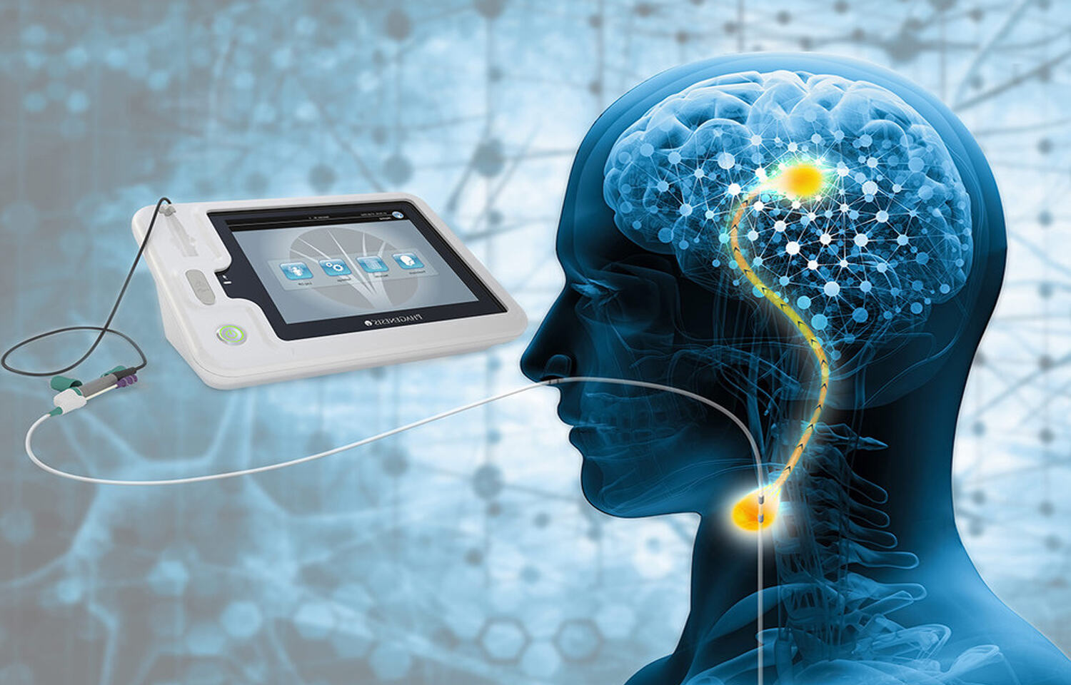 Personalized brain stimulation alleviates severe depression symptoms