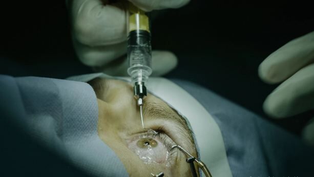 Ultra-rapid cooling proves a good alternative anesthesia for ...