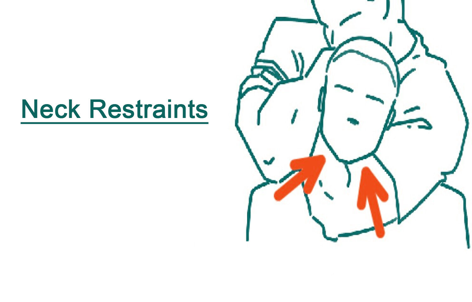 Neck restraints to control aggressive people not medically appropriate ...