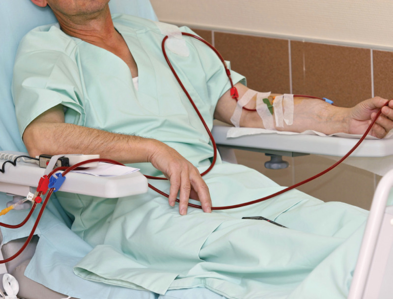 Dyskalemias Before Dialysis Increases Risk of Post-Dialysis mortality