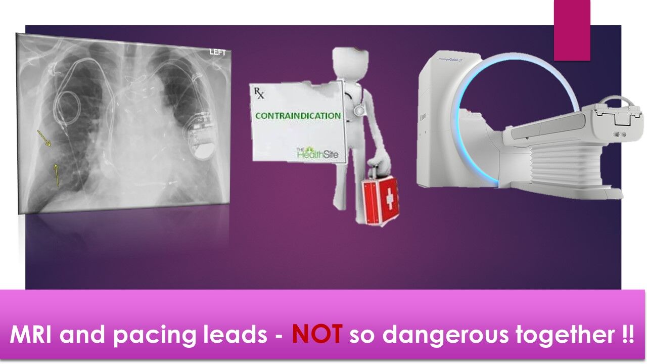 MRI "safe" for patients with abandoned leads, study challenges the ...