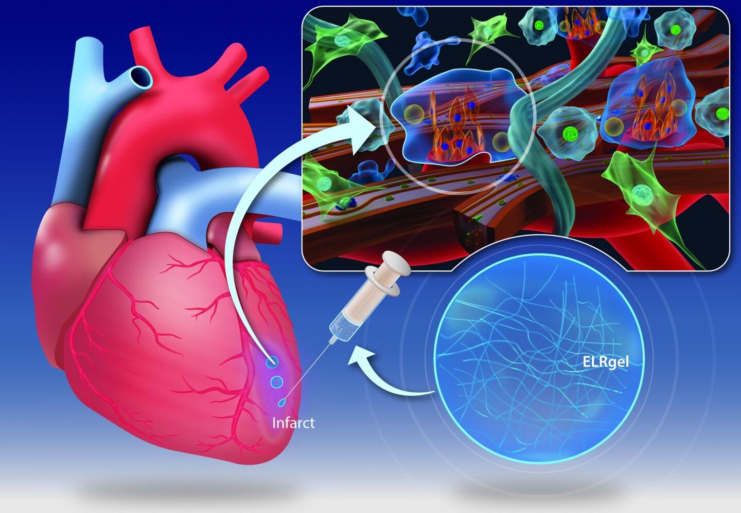 Hydrogel injection may change the way the heart muscle heals after a ...