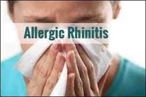 Pharmacological management of allergic rhinitis: MSAI issues consensus ...