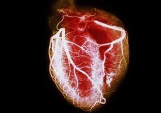 Consensus Expert panel revises definition, classification and staging ...