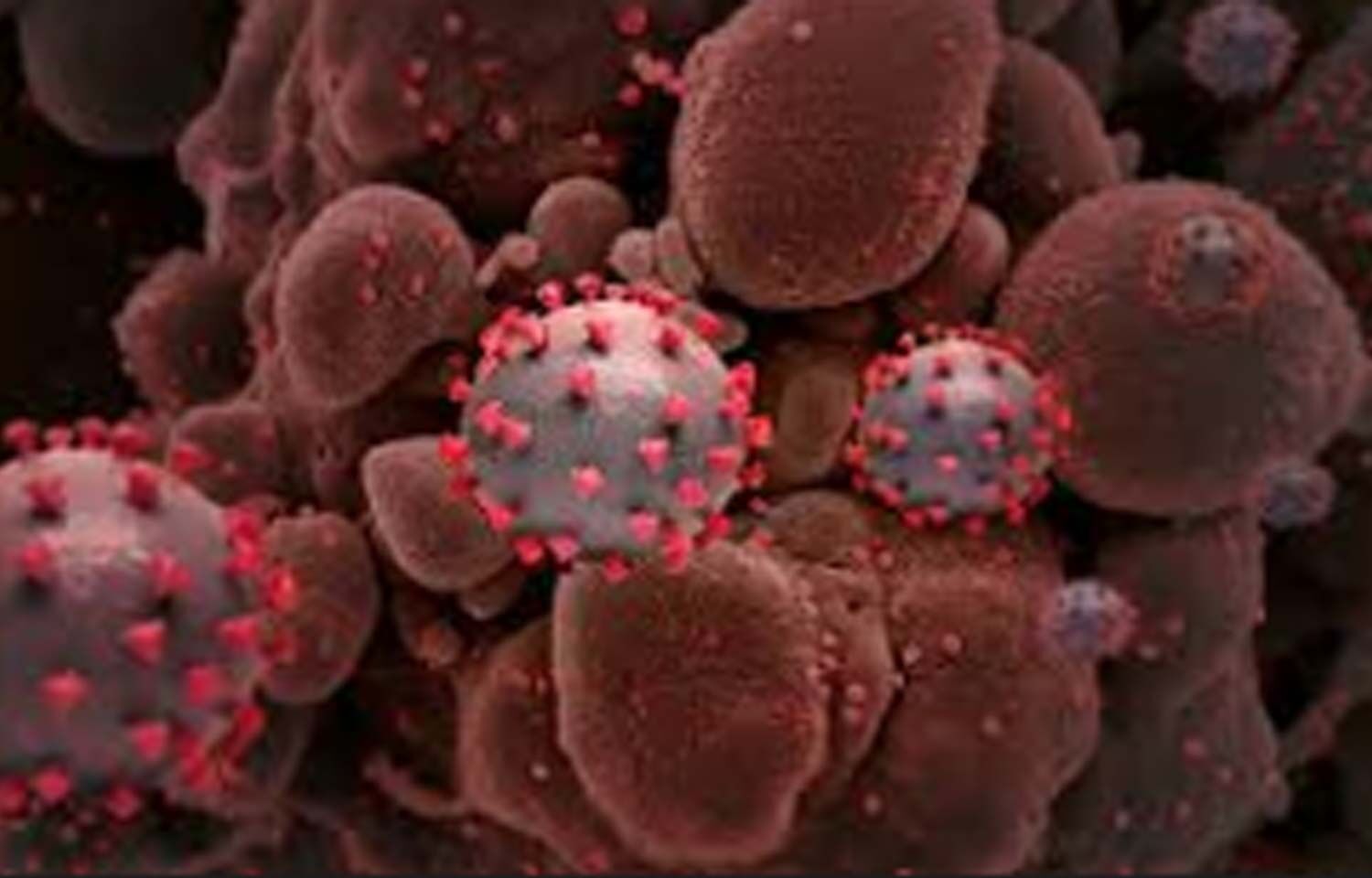 Experimental therapy for parasitic heart disease may also help stop ...