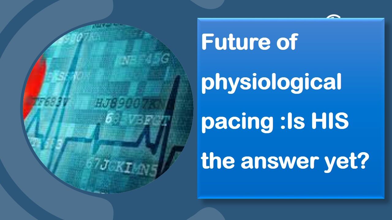 HIS bundle pacing as good as CRT, the "catch" is higher thresholds, HIS ...