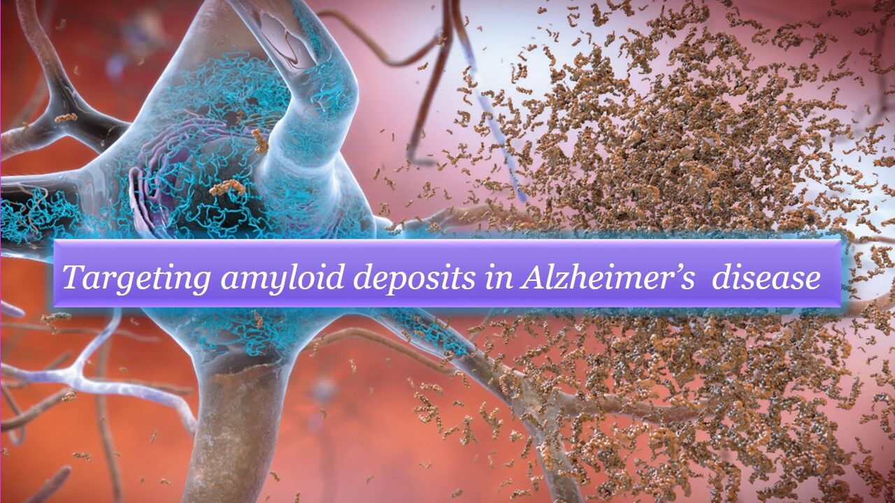 Novel drug targeting amyloid plaques offers tentative hope for ...