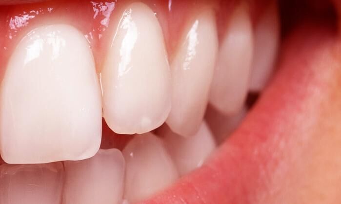 Functional tooth units help evaluate occlusal status, Study reveals