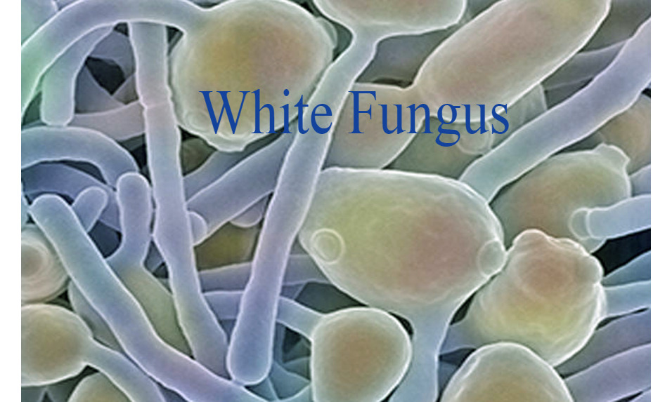Sir Ganga Ram Hospital reports first ever white fungus case in Delhi