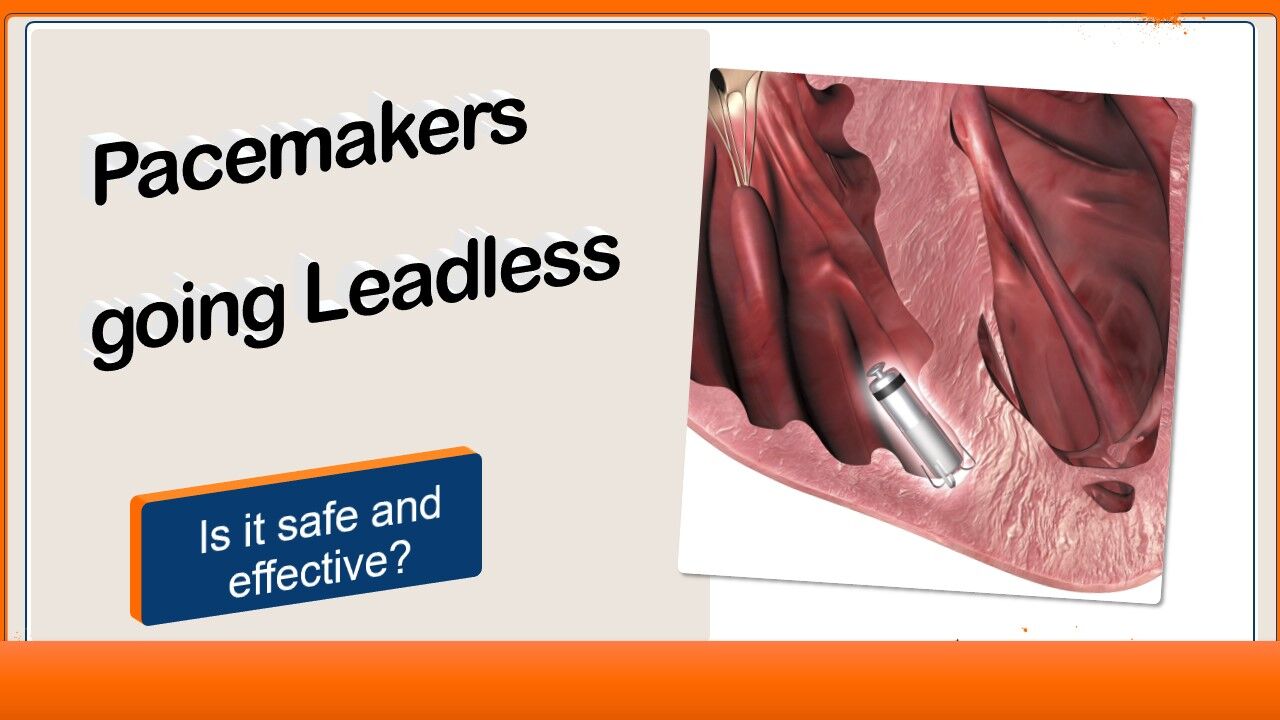 "Leadless" leading the way ahead - JAMA study provides reassuring ...