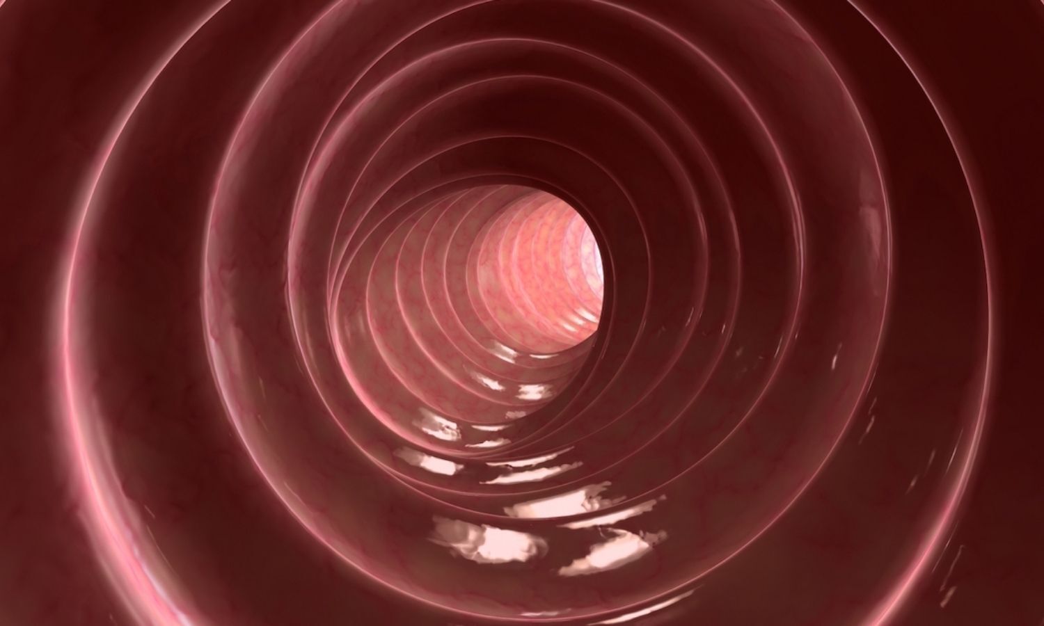 Guideline for treatment of microscopic colitis