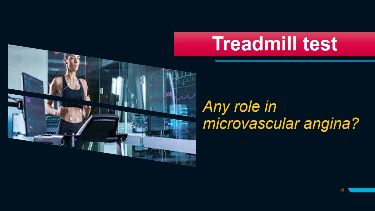 TMT has role in diagnosing coronary microvascular disease, JACC study.