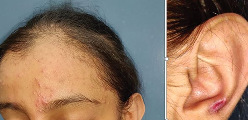 Turban Triad- Entity that highlights role of cultural factors in ...