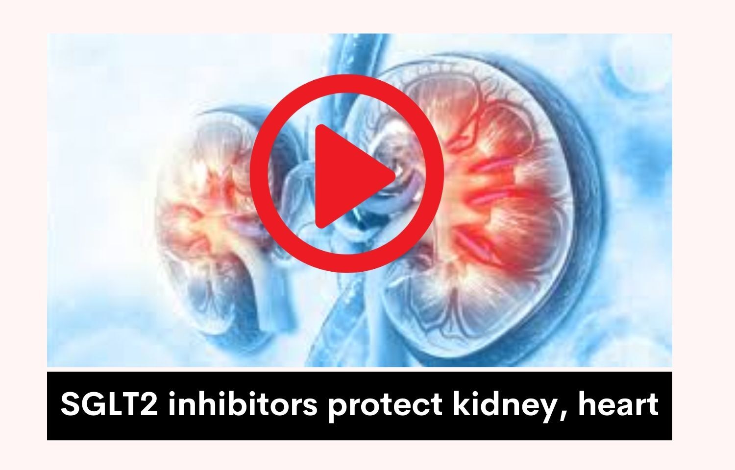 SGLT 2 inhibitors provide kidney, cardiovascular benefits for diabetes ...