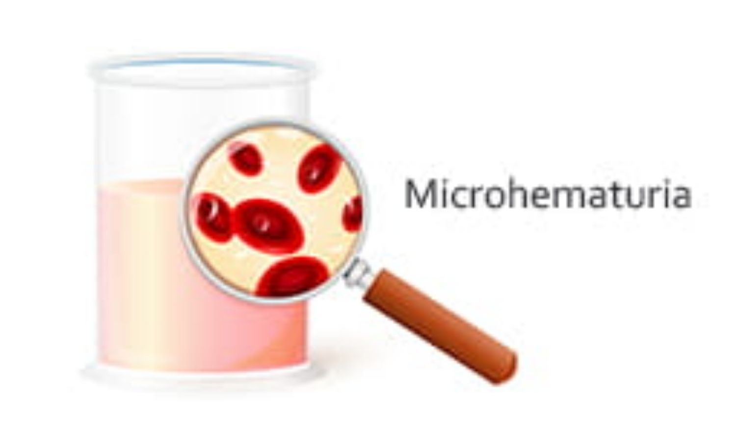 Urologic malignancy risk is very low in women evaluated for ...