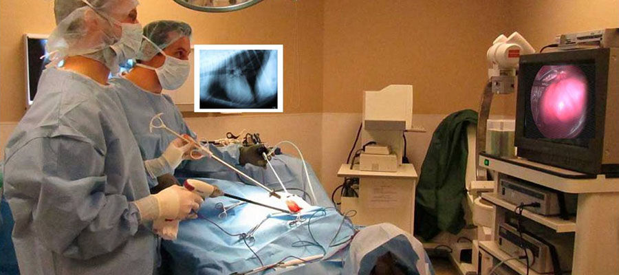 Thoracoscopy safe surgical option for Gross type C esophageal atresia ...