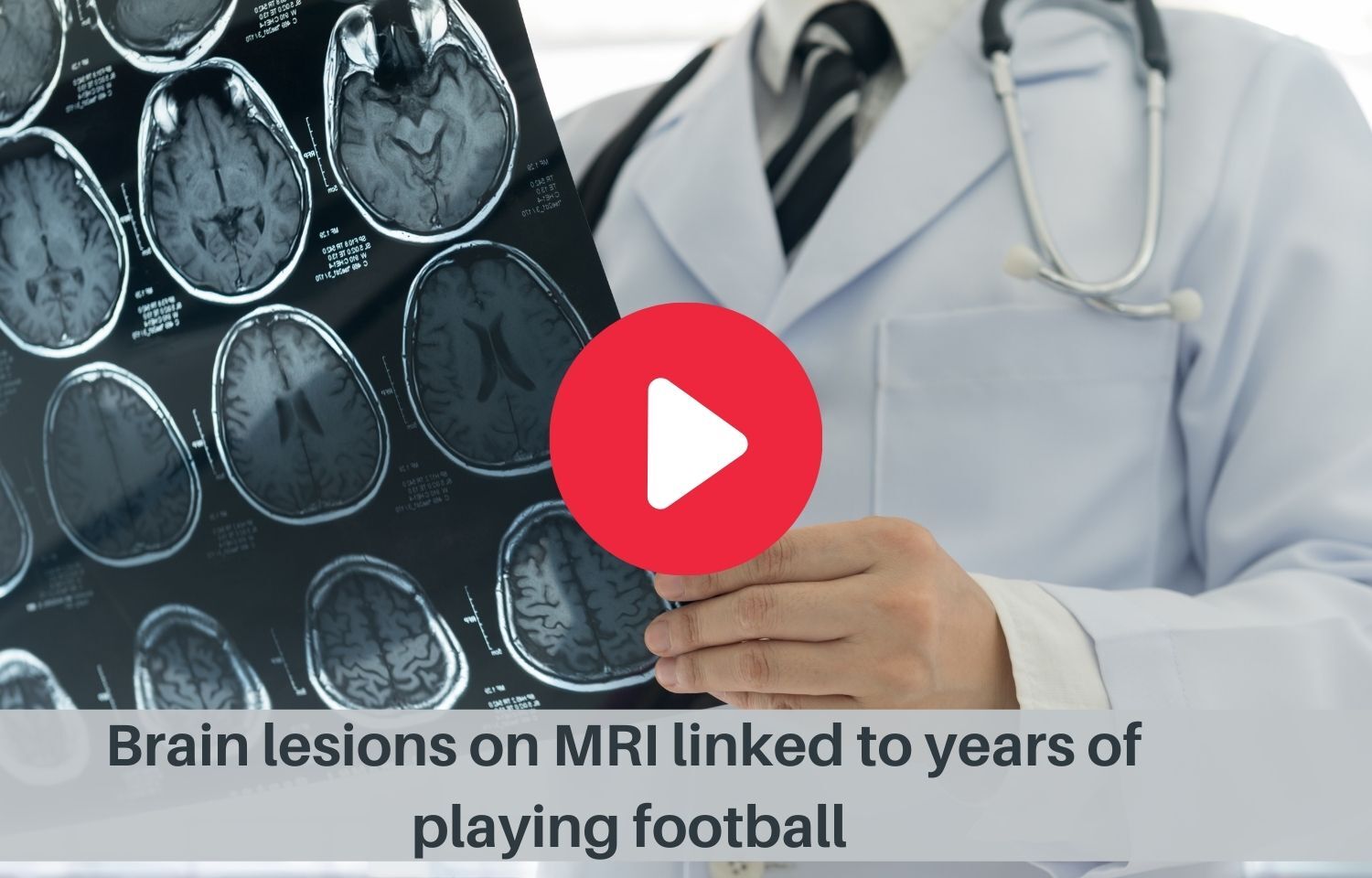 Brain lesions diagnosed on an MRI linked to years of football play