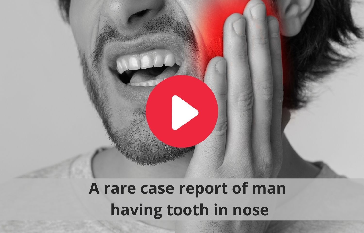A rare case report of man having tooth in nose
