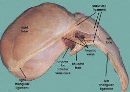 A falciform ligament wrap around the hepatic artery effective in ...