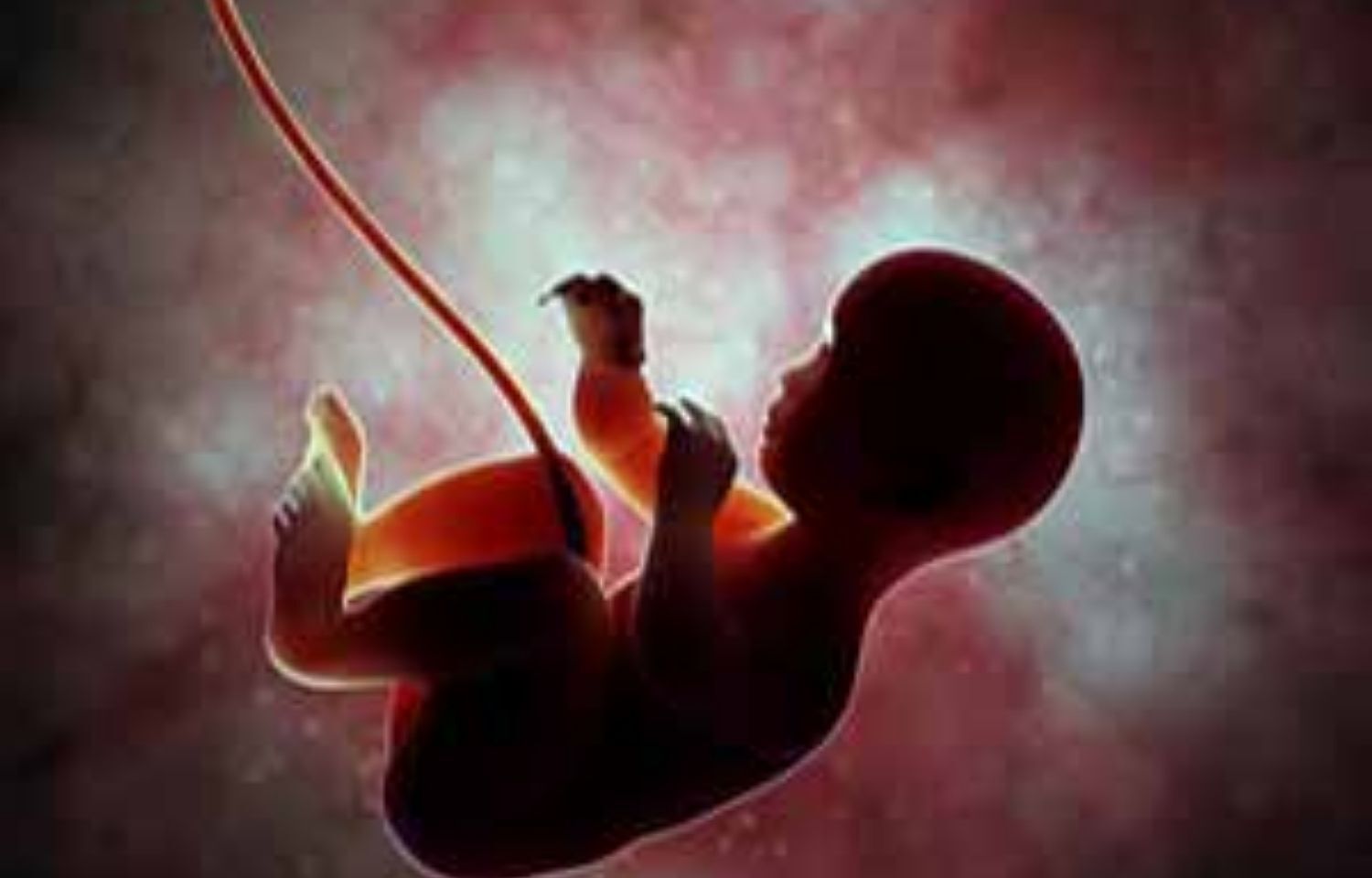 Umbilical cord management in preterm and term infants- SOCG/CPS release ...