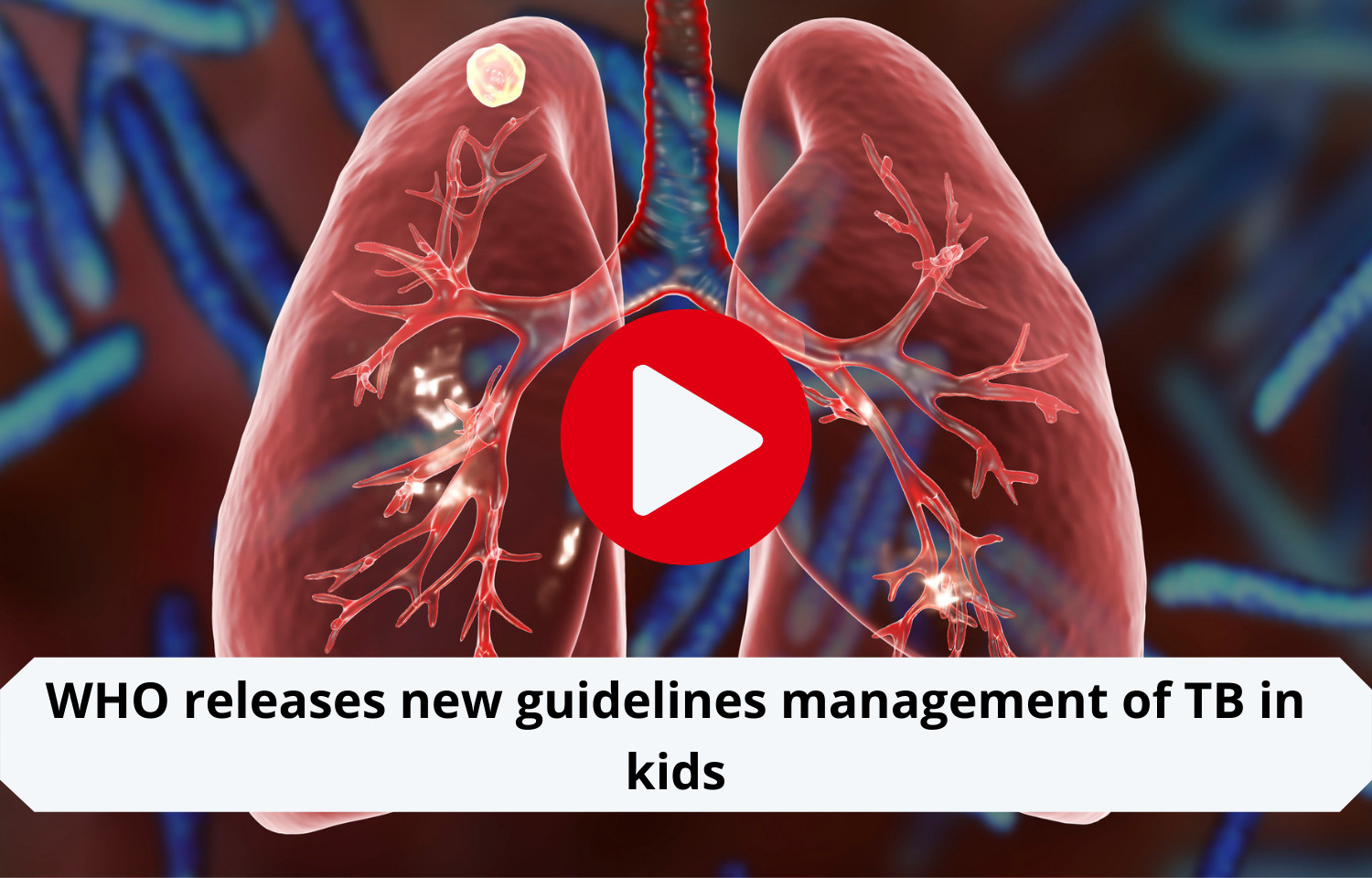 WHO releases new set of guidelines management of Tuberculosis in kids