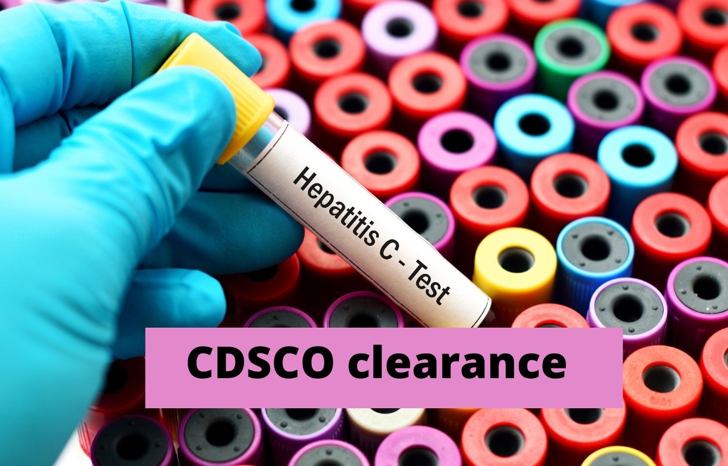 CoSara Diagnostics gets CDSCO clearance for Hepatitis C Viral Load Test