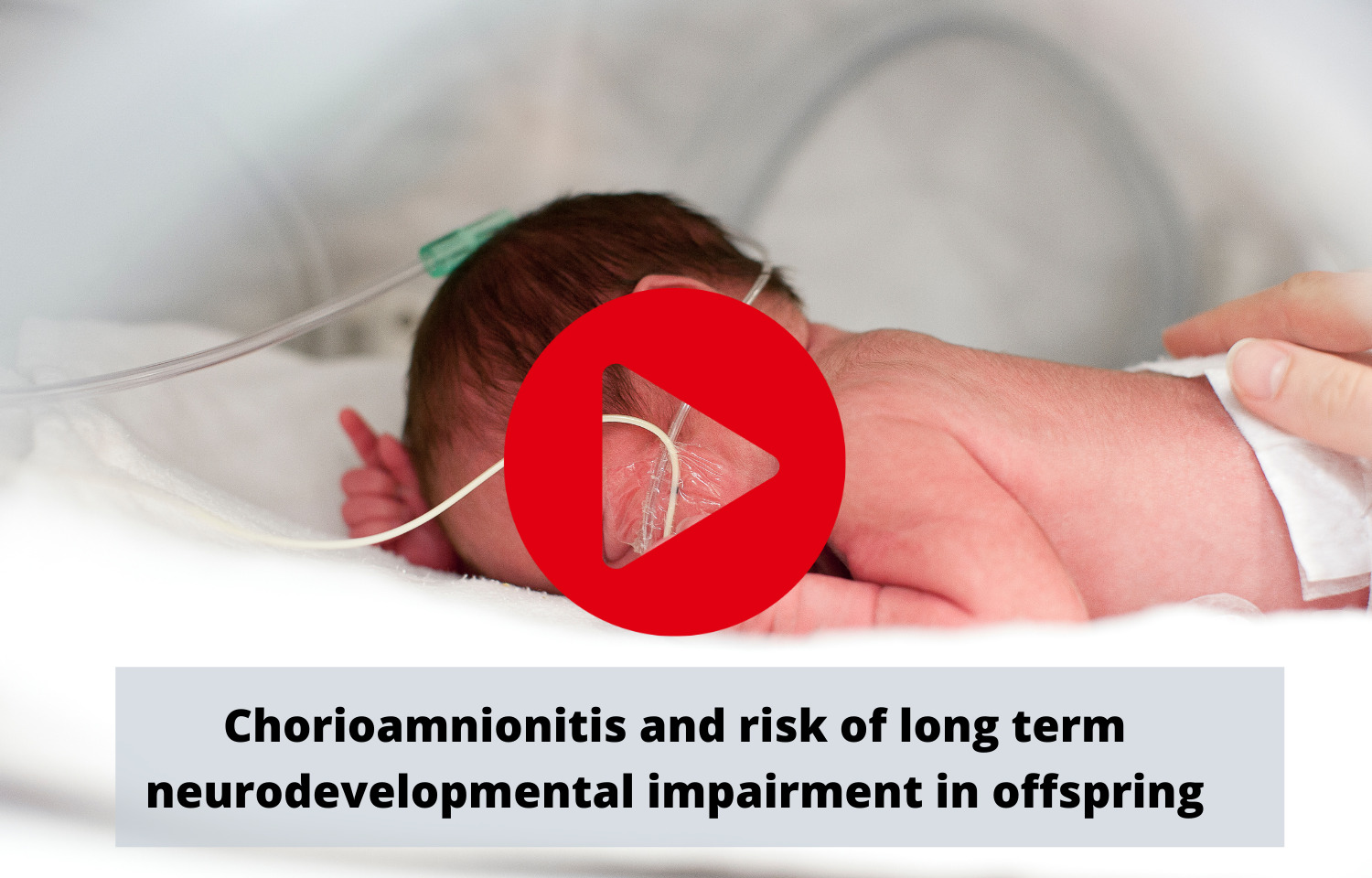 Chorioamnionitis and risk of long term neurodevelopmental impairment in ...