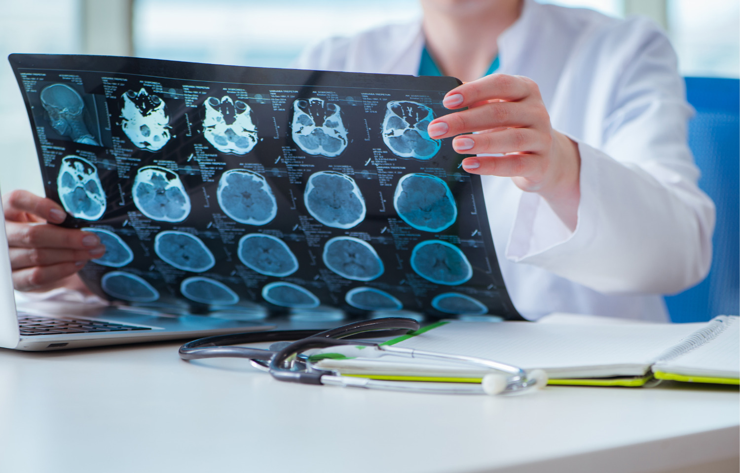 MRI identifies markers of atypical brain development in children born ...