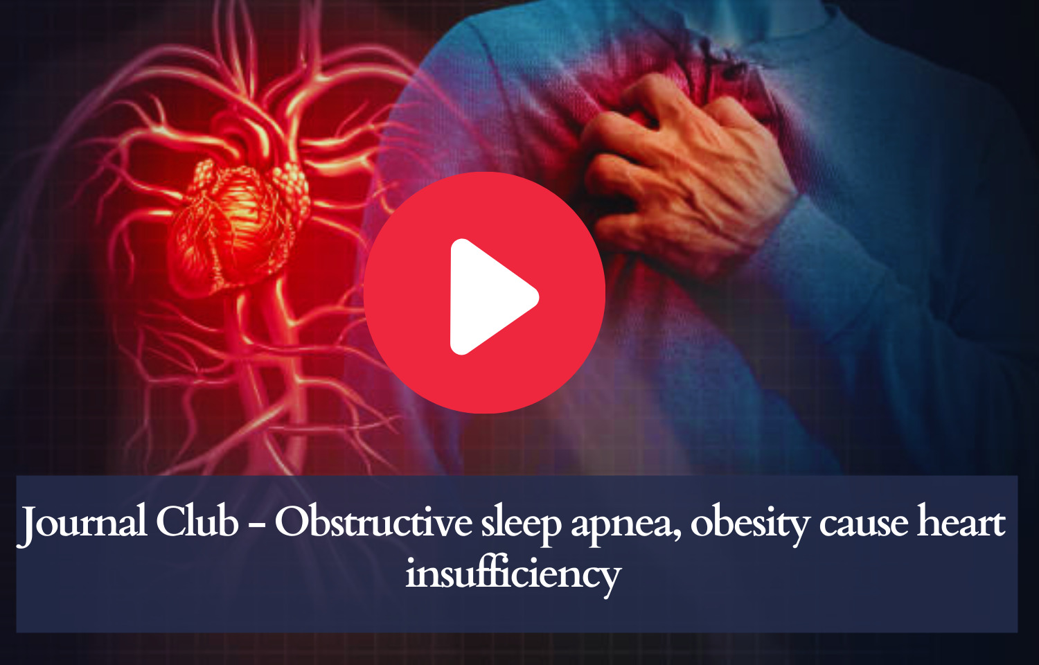 Journal Club - Obstructive sleep apnea, obesity to cause heart ...