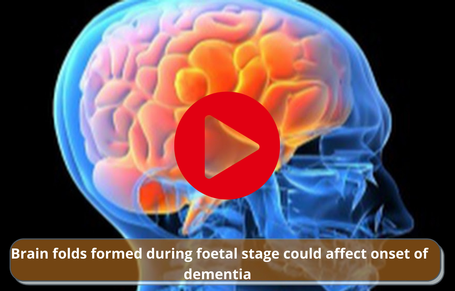 Brain folds formed during foetal stage could affect onset of dementia