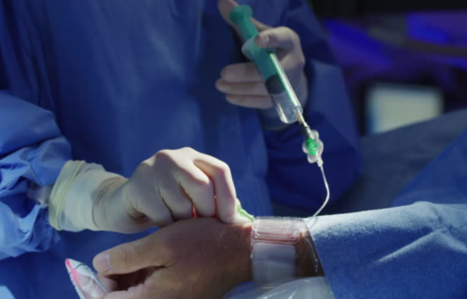 Novel distal radial access for cardiac catheterization safe strategy ...