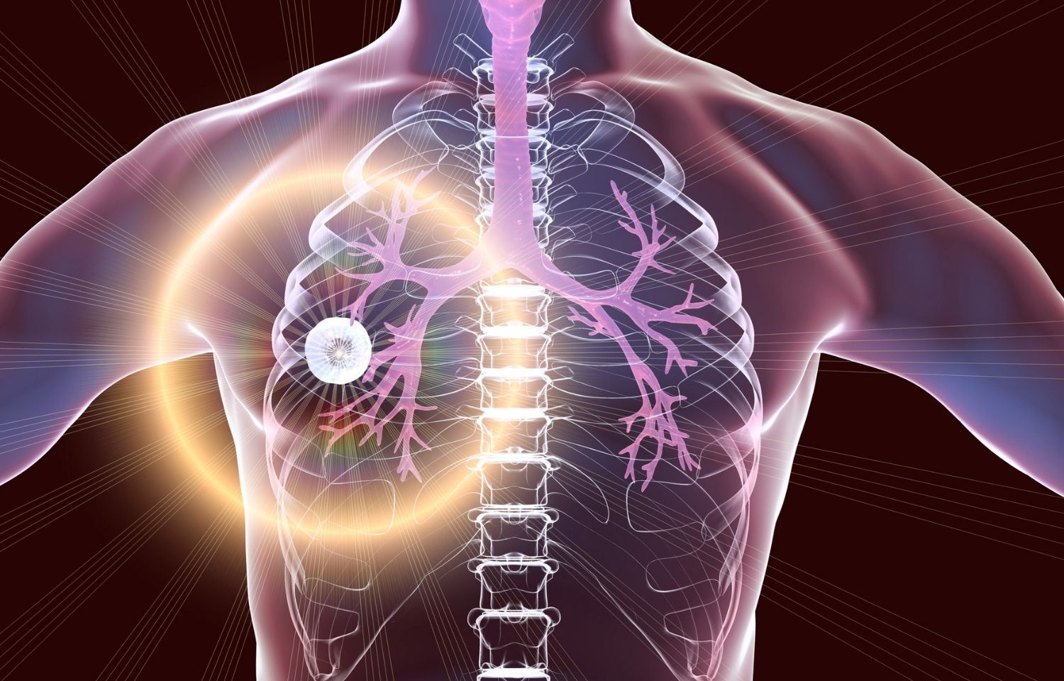 New blood test can help doctors diagnose tuberculosis and monitor treatment