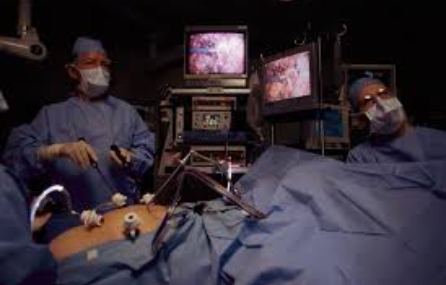 Blood levels of ceramides predict diabetes remission among patients ...