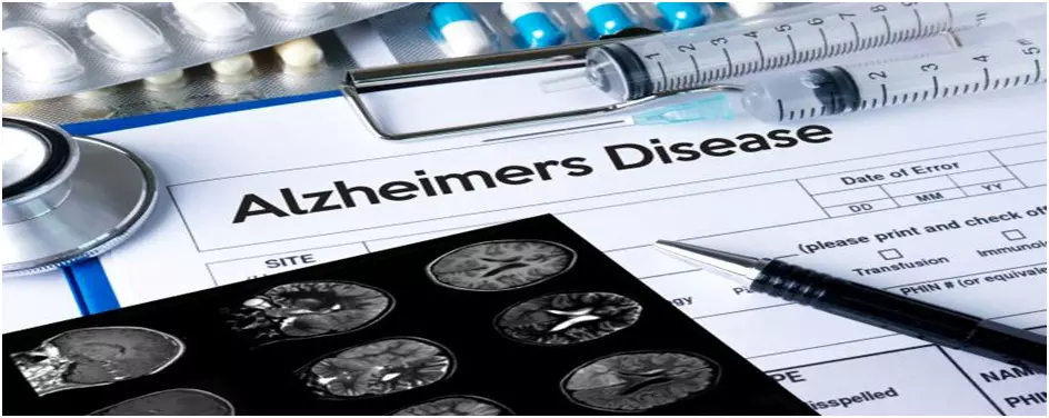 Anti-tau antibody Semorinemab fails to slow Alzheimer's disease ...