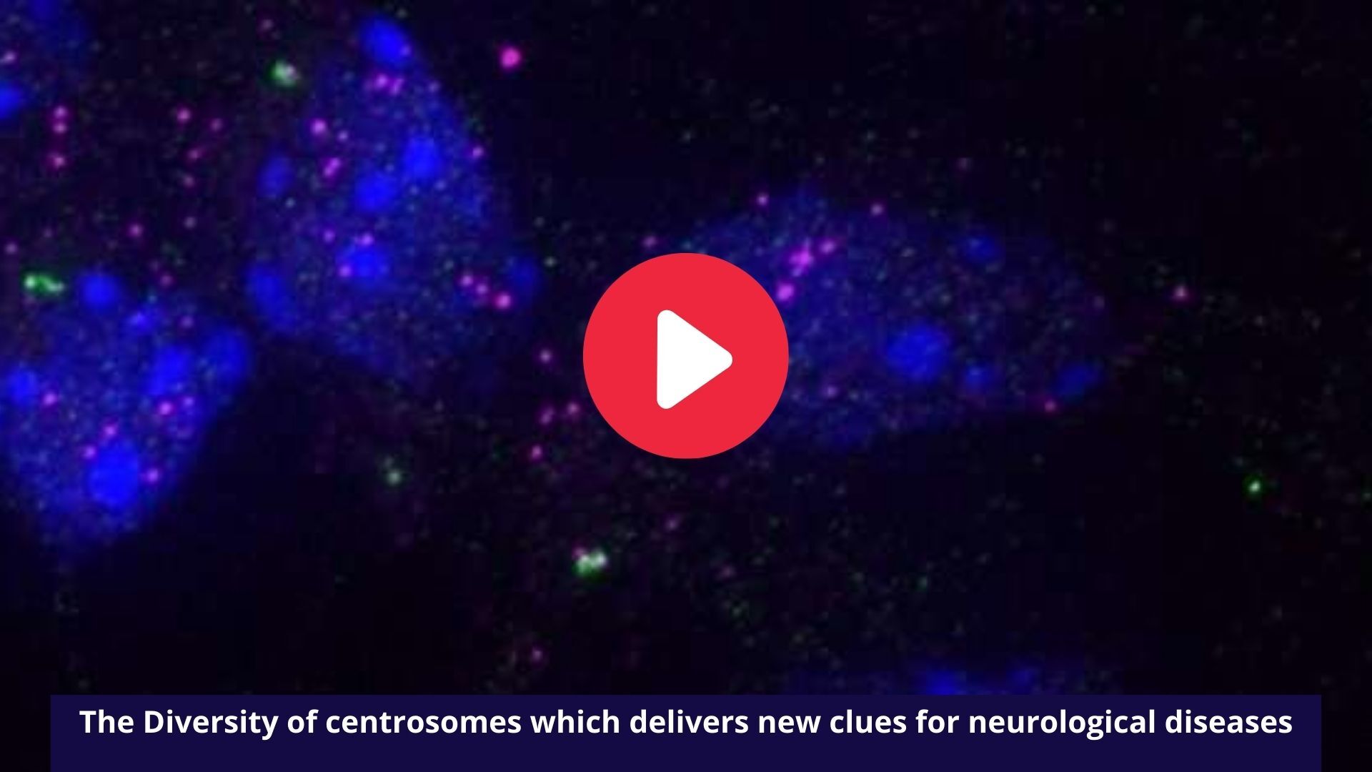 The Diversity of centrosomes which delivers new clues for neurological ...