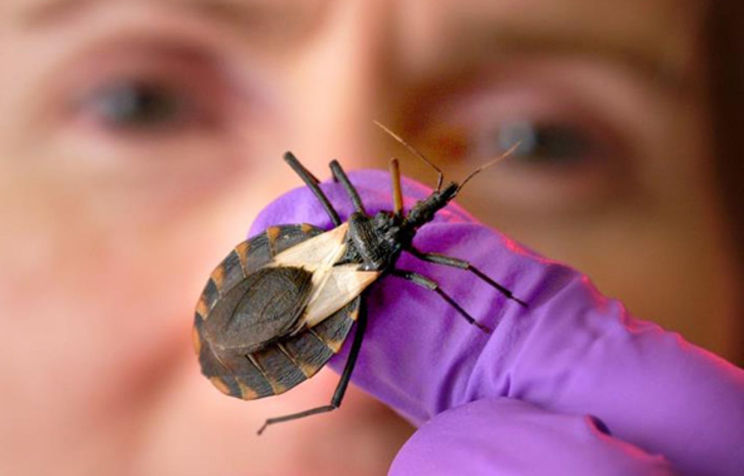 CMR reveals myocardial injury in patients with Chagas disease for first ...