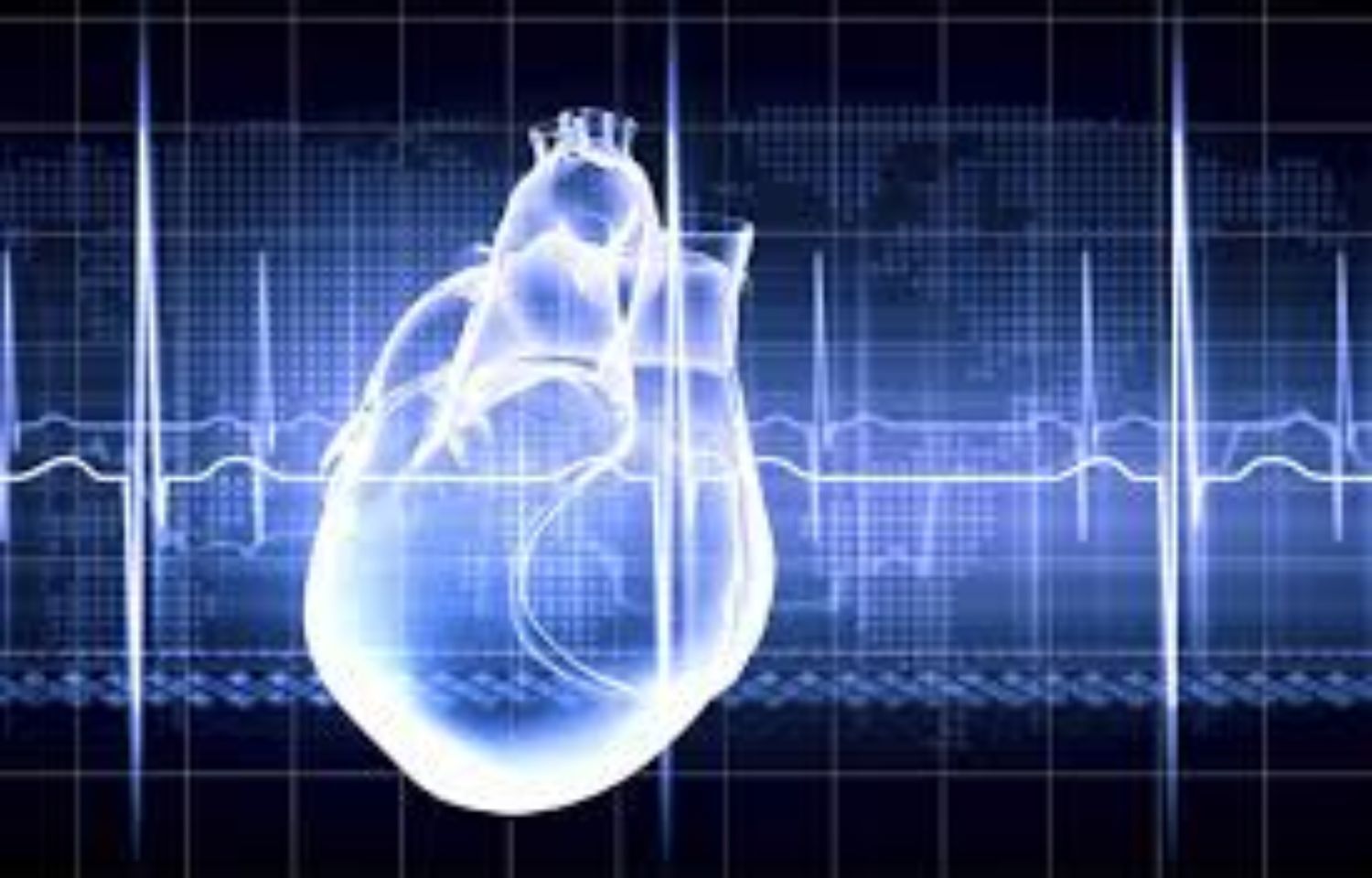 Advanced MRI benefits patients with heart stiffening disease