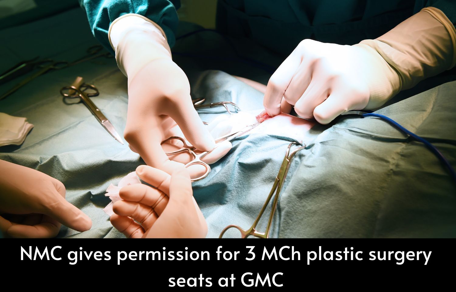 NMC allots 3 MCh plastic surgery seats to GMC Guntur