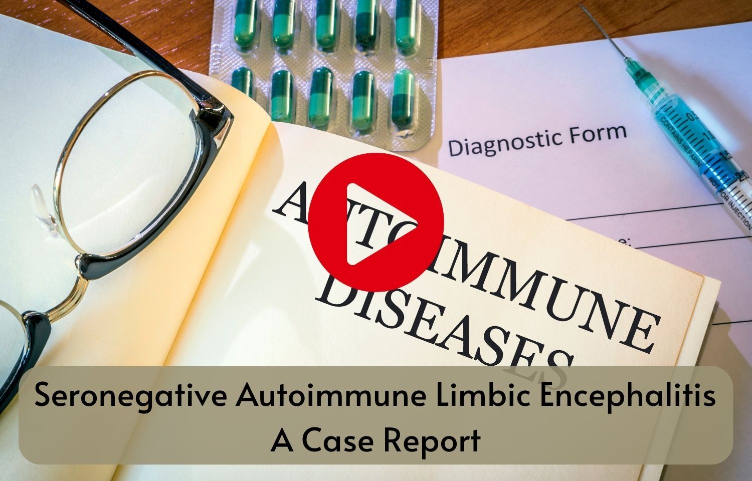 Seronegative Autoimmune Limbic Encephalitis A Case Report