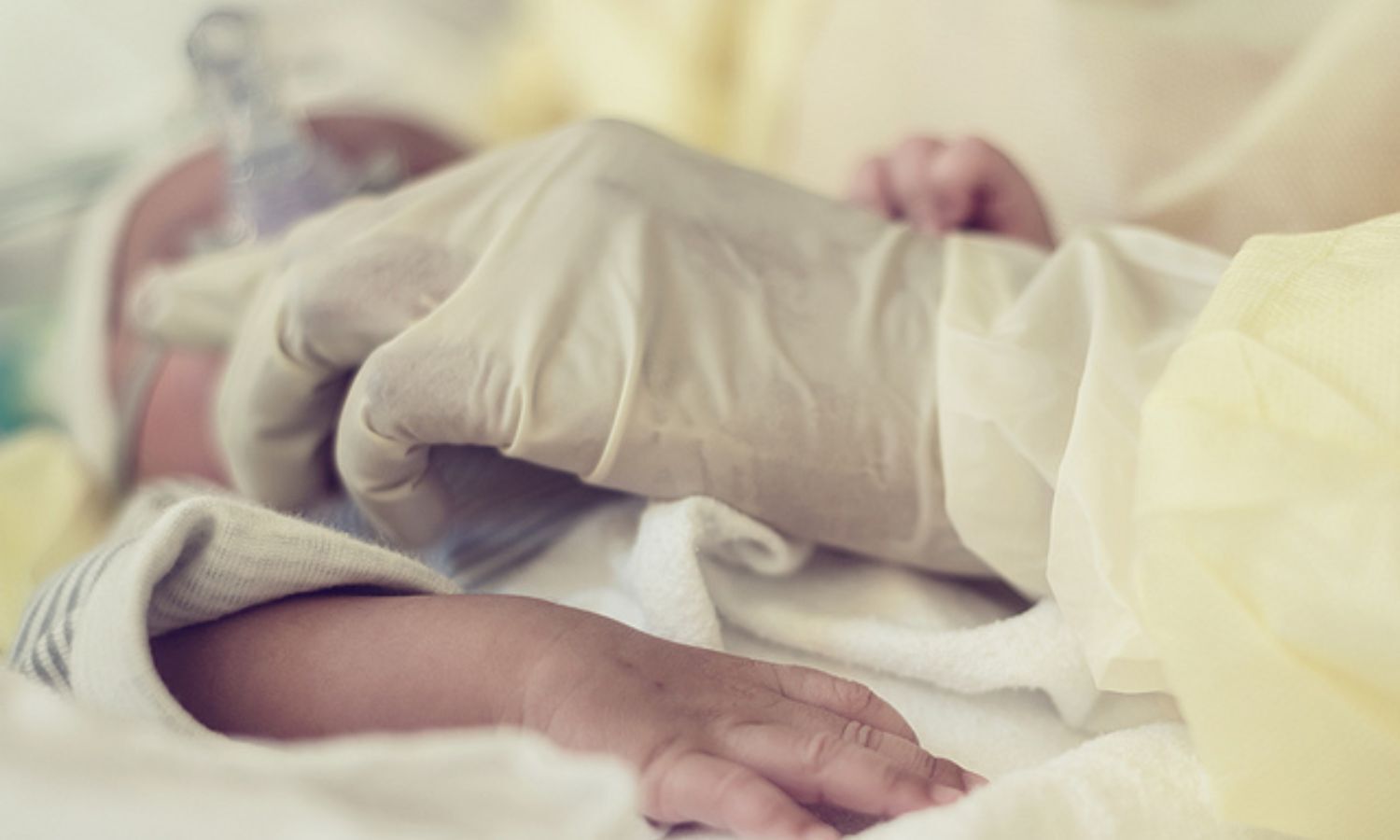 Prone Positioning Fails to Reduce Ventilation Need in Infants With ...