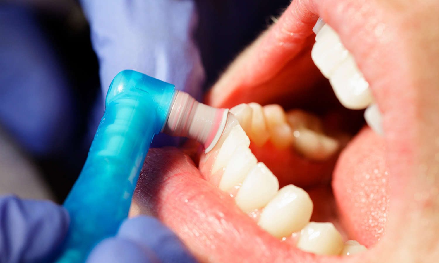 Automated polishing best for reducing surface roughness of polymethyl ...