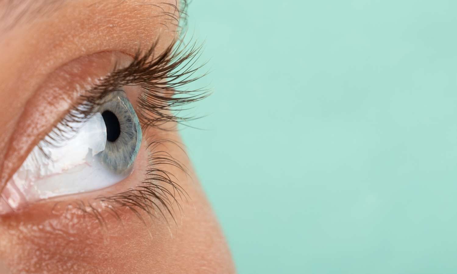 Continuous Intracorneal Ring Implantation reversibile with low rates of ...