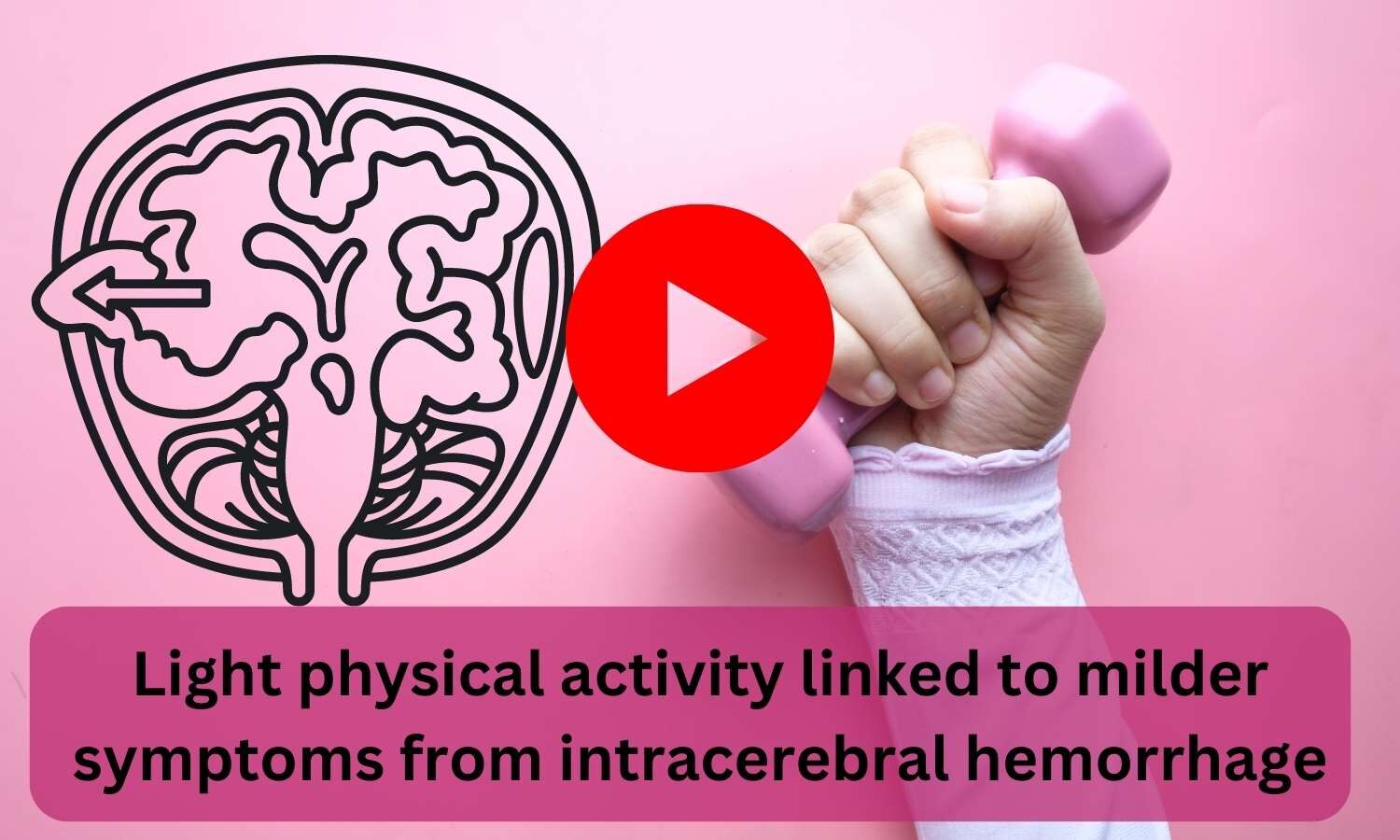 Light physical activity linked to milder symptoms from intracerebral ...